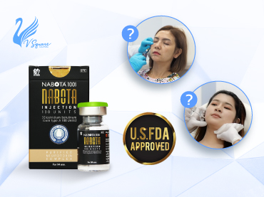 โบท็อกซ์นาโบตะ (Nabota Botox) ข้อดี-ข้อเสีย ต่างจากยี่ห้ออื่นเรื่องใดบ้าง?