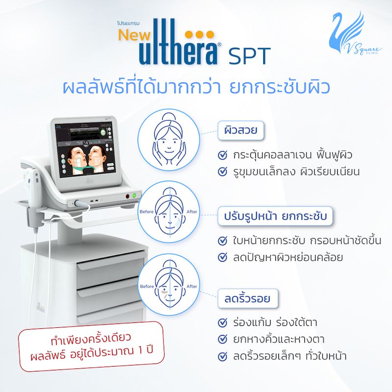 Ulthera SPT คืออะไร “See Plan Treat” ยกกระชับผิว เทคนิคใหม่ ปี 2022