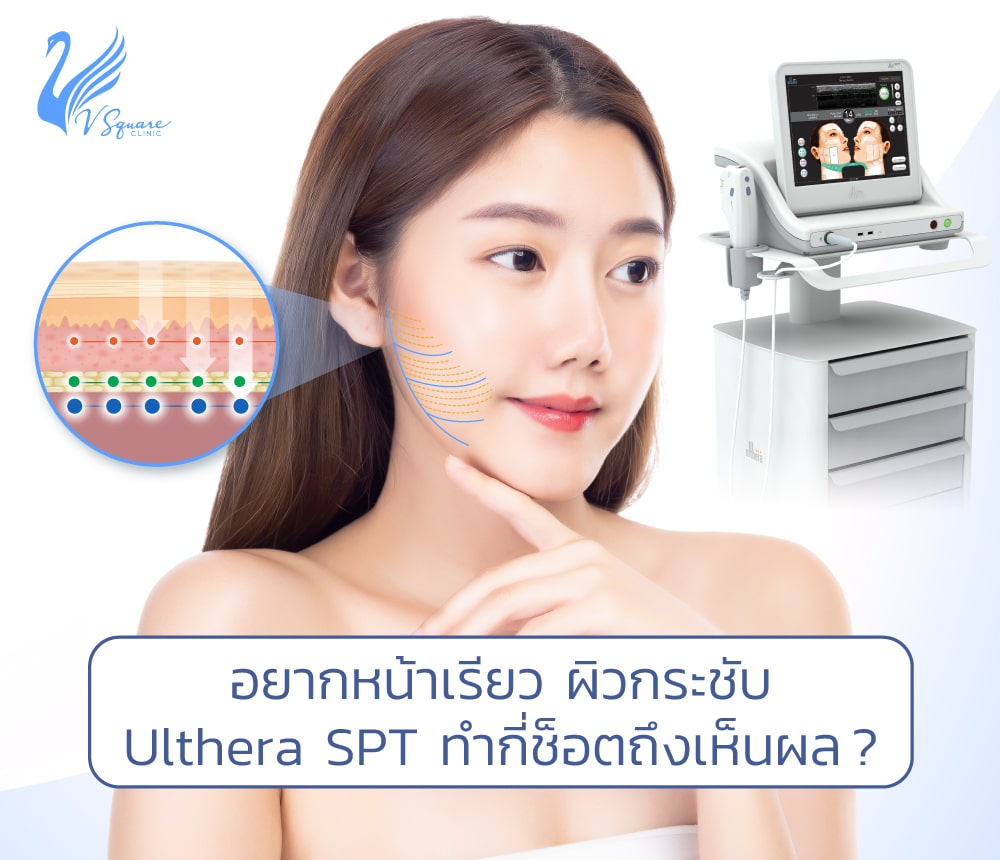 Ulthera ทํากี่ช็อต เห็นผล ช็อต VS ไลน์ ต่างกันอย่างไร ทำกี่ครั้งเห็นผล