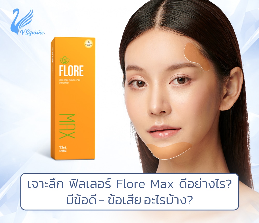 ฟิลเลอร์ยี่ห้อ Flore Max ดีอย่างไร ? มีข้อดี - ข้อเสียอะไรบ้าง
