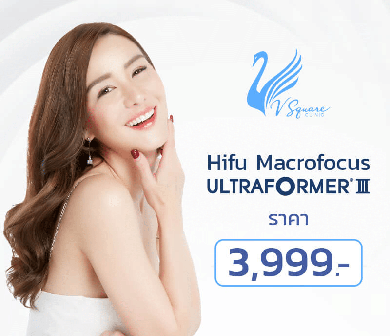 Ultraformer ราคาเท่าไหร่ ? ราคาถูก-แพง คุณภาพต่างกันไหม ช่วยอะไรบ้าง