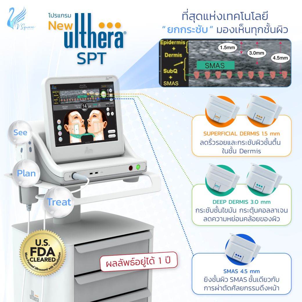 Ulthera คืออะไร ราคาเท่าไหร่ ยกกระชับลดริ้วรอย เห็นผลในกี่วัน