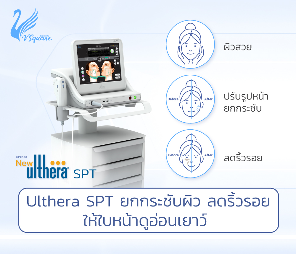 Ulthera คืออะไร ราคาเท่าไหร่ ยกกระชับลดริ้วรอย เห็นผลในกี่วัน