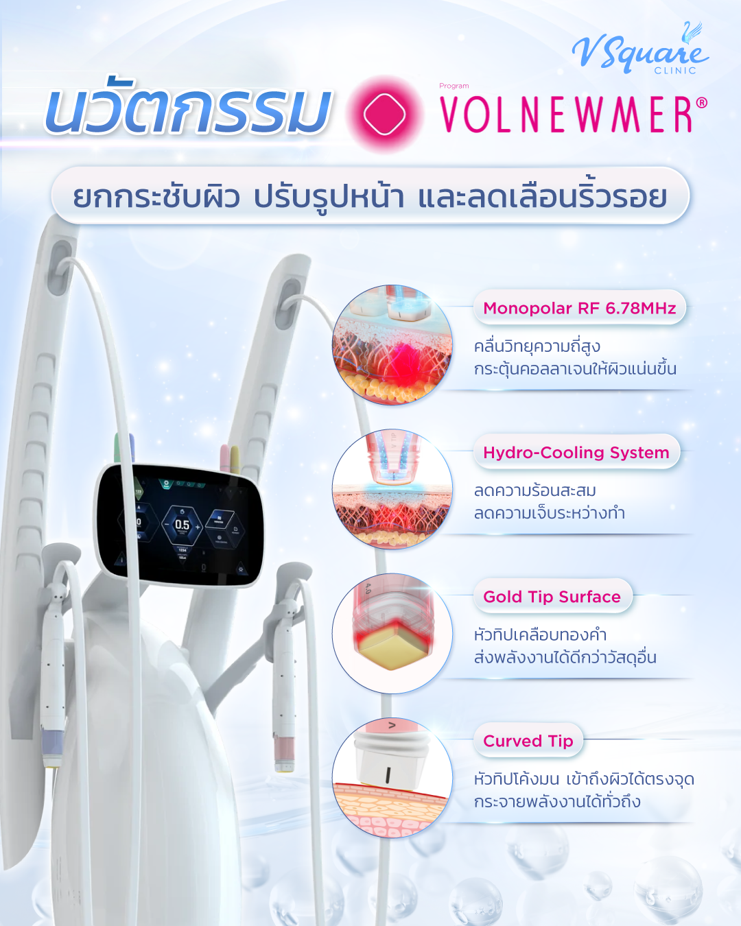 Volnewmer คืออะไร ? รู้ข้อดี ราคา และผลลัพธ์หลังทำ